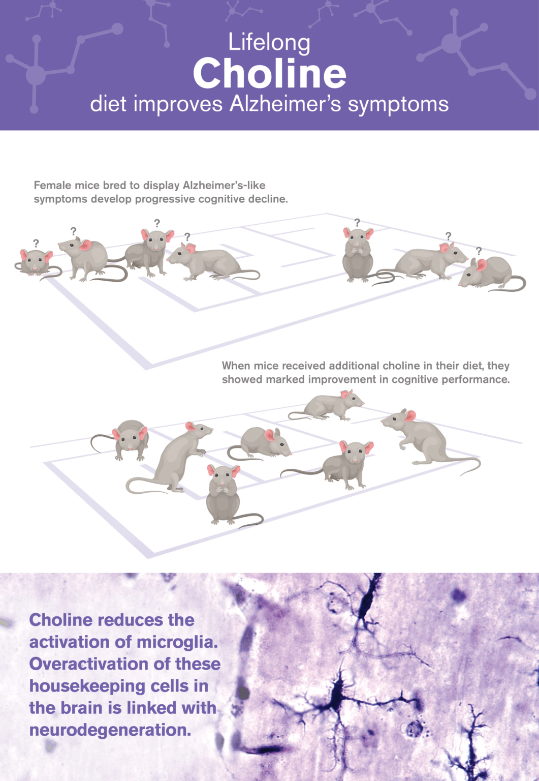 The Choline - Diet - Alzheimer's Connection